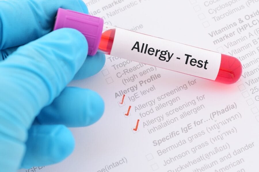 Complete Guide to Allergy Testing and Treatment Options